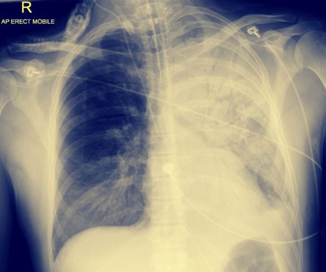 Kortison tabletter prednisolon — Nästa dag leverans